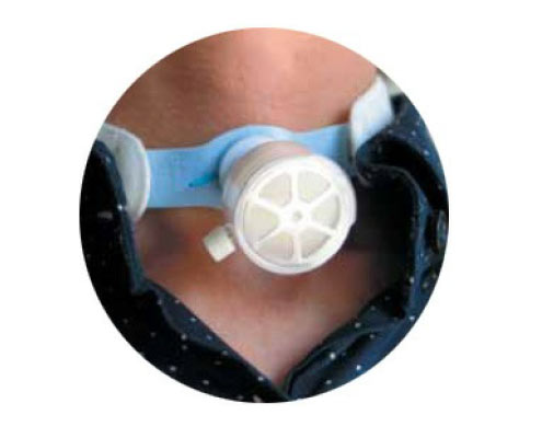 spiro speaking valve - Athrodax